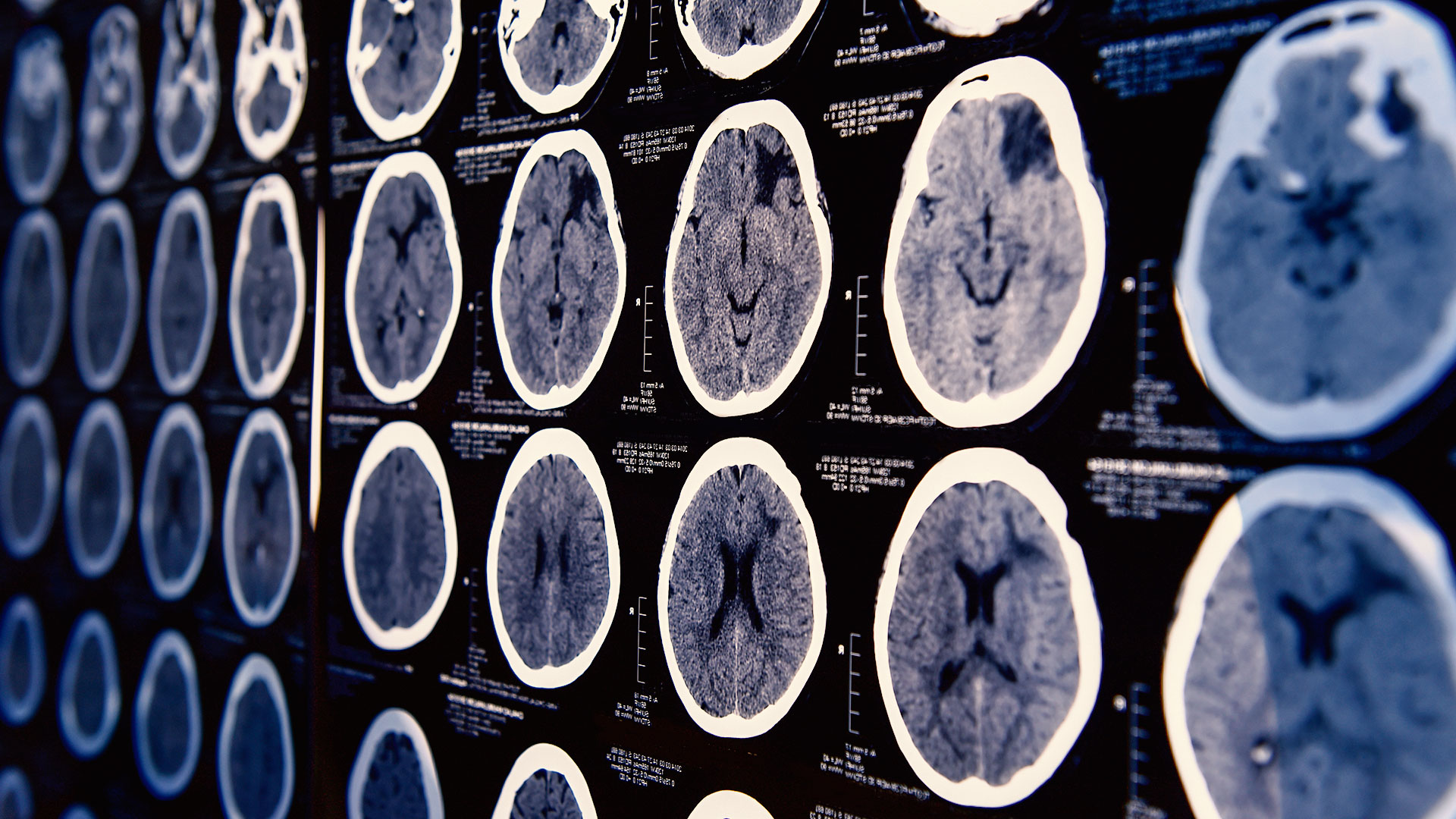 Detecting Disease: Israeli Scientists Discover How to 'See' Molecular ...