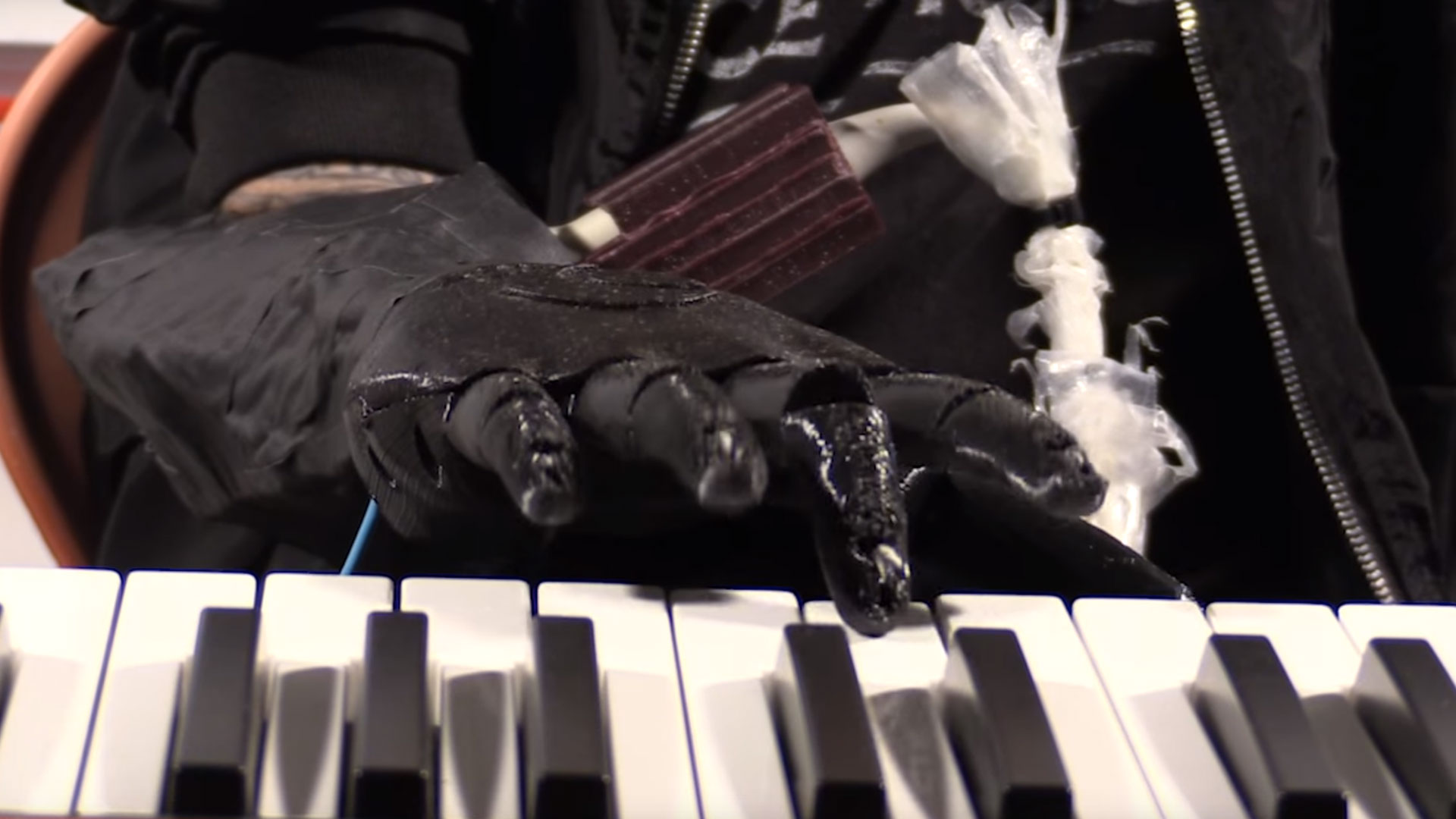 Luke Skywalker's Bionic Hand? Artificial Hand Uses Ultrasound for ...