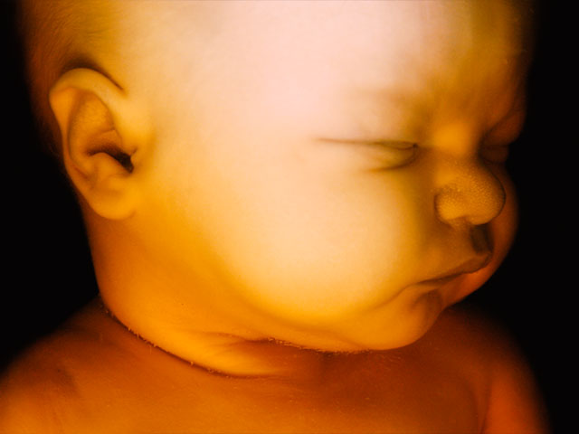 How One Group Saved More than 400 Babies from Death | CBN News